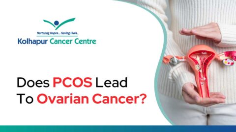 How do PCOS and ovarian cancer differ? - Kolhapur Cancer Centre