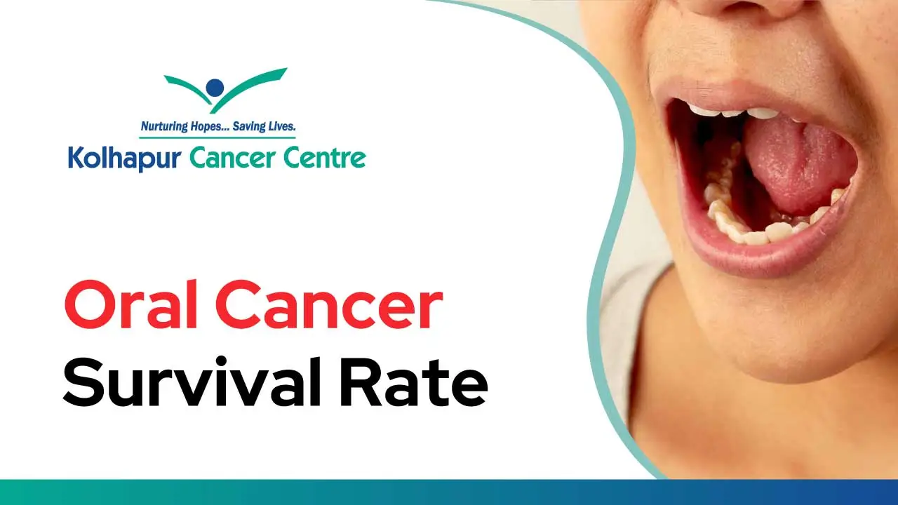 Oral Cancer Survival Rates: Key Facts, Prevention, and Treatment